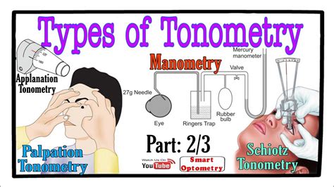 Tonometry All Types Of Tonometry 23 Youtube