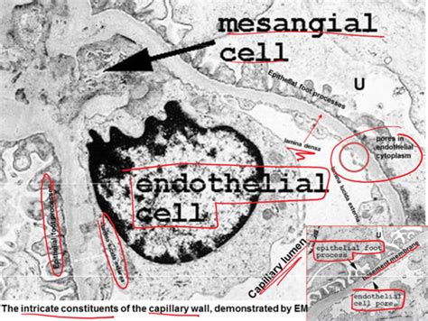 Glomerular Basement Membrane Histology