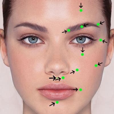Botox For Facial Palsy 2