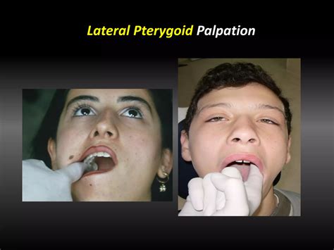 Tmds And Occlusal Splint Therapy Pdf
