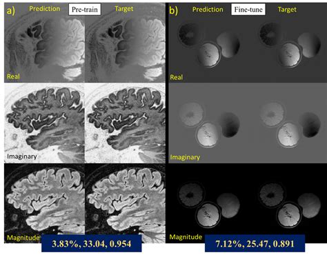 Proposed Network Architecture With Branches Denotesthe U NET Like Convolutional Neural Network