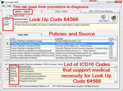 Screenshot Tour Crosscoder
