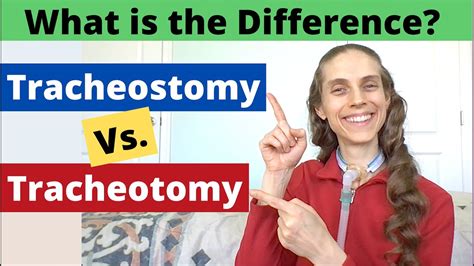 Tracheotomy Versus Tracheostomy What Is The Difference Life With A Vent Youtube