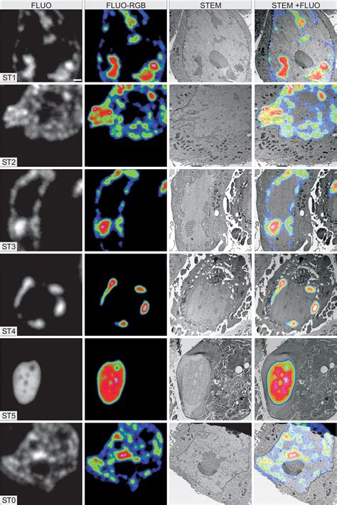 Cryo Correlative Fluorescence And Scanning Transmission Electron Download Scientific Diagram