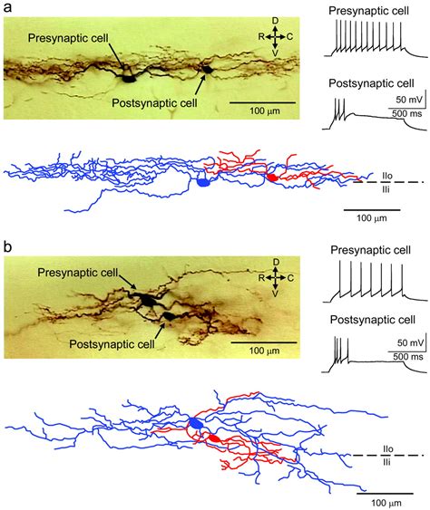 Presynaptic Neuron Vs Postsynaptic Neuron