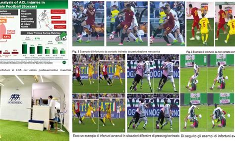 Linfortunio Al Legamento Crociato Anteriore Come Dove E Quando