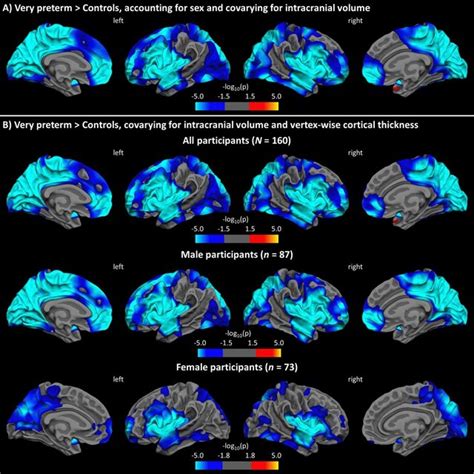 Results From General Linear Models Testing For Group Differences In Download Scientific Diagram