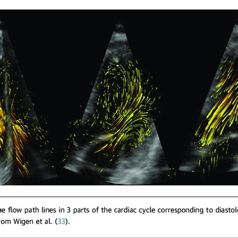 4 dimensional vector flow imaging download scientific diagram