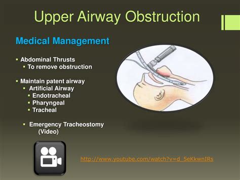 ppt disorders of the upper airway powerpoint presentation free