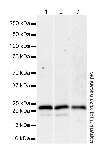 Western Blot Protein Size Ladder Detroitdolf