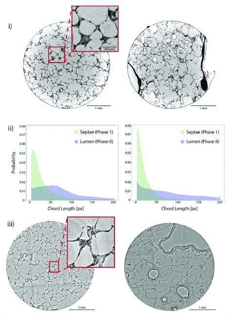 Chord Length Distribution I Tomographic Slices From A Young Lung
