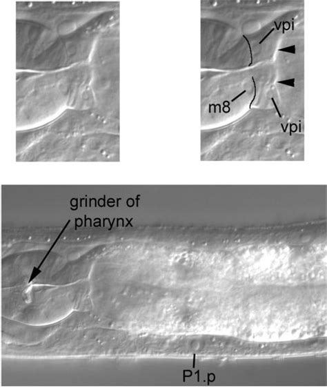 Figure 38 Several Vpi Nuclei In The Pharyngo Intestinal Valve