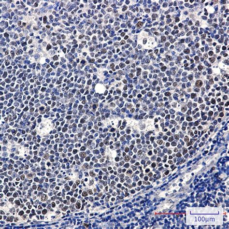 Mcm2 Rabbit Mab Wb Ihc P Ihc F Ip Icc Buy Now