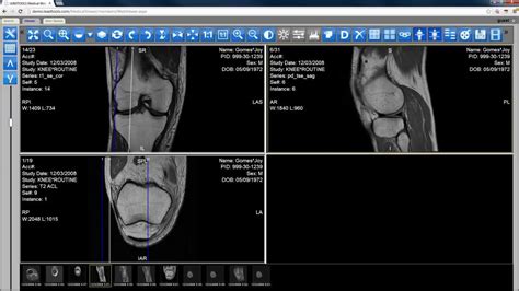 New Html5 Zero Footprint Dicom Viewer In Leadtools Version 18 Youtube