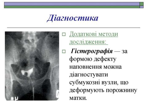 Доброякісні пухлини жіночих статевих органів Лекція презентация онлайн