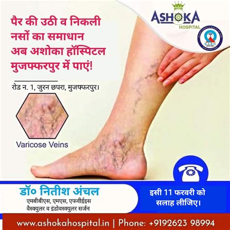 दिल्ली के डॉक्टर अब Ashoka Hospital Muzaffarpur