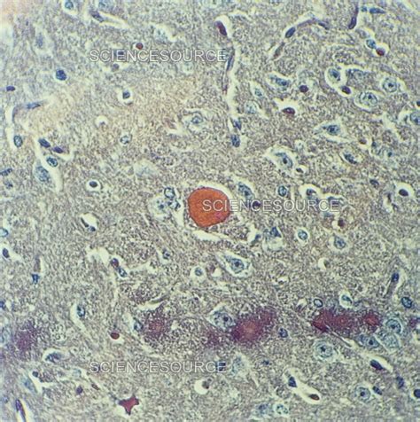 Photograph Toxoplasma Gondii Sporocyte In Human B Science Source Images