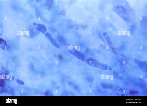 This Photomicrograph Of A Corneal Tissue Sample Was Harvested From A