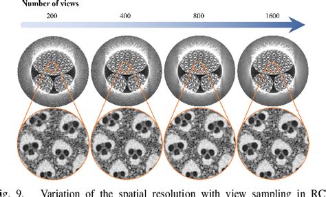 Figure 9 From Multiple Source Translation Micro Ct Improves Both Field