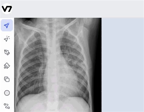 V7 Snaps Up 33m To Automate Training Data For Computer Vision Ai Models Techcrunch V7 Snaps Up 33m To Automate Training Data For Computer Vision Ai Models Techcrunch