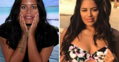 Love Islands Malin Andersson Reveals Shock £7k Surgery Overhaul