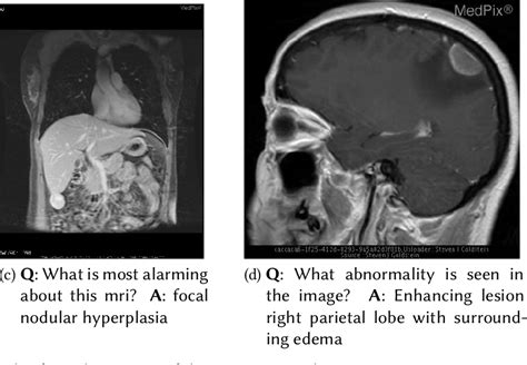 Figure 1 From Overview Of The VQA Med Task At ImageCLEF 2021 Visual