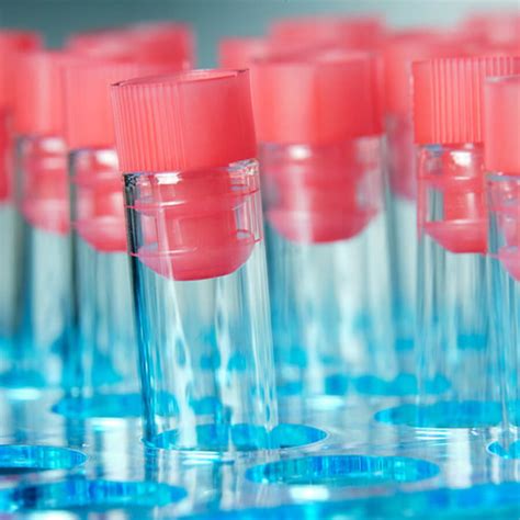 Enhancing Ivf Success The Role Of Comprehensive Sperm Testing