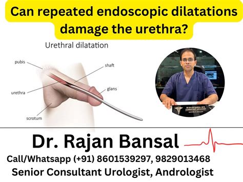 Understanding Urodynamic Study A Comprehensive Guide To Bladder