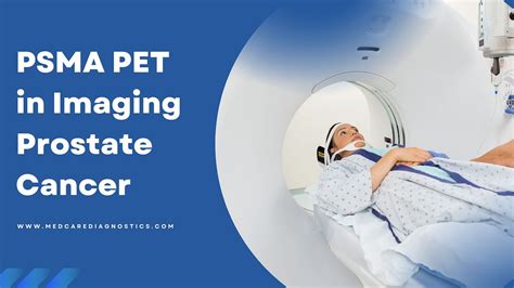 Psma Pet In Imaging Prostate Cancer By Medcare Dignostics Medium