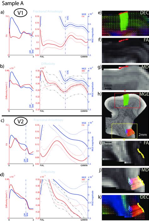 Cortical Profiles Of Diffusion Metrics For Sample A The Upper Panel Download Scientific
