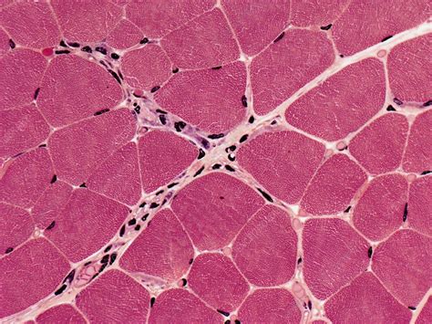 Skeletal Muscle Light Micrograph Stock Image C0296651 Science Photo Library