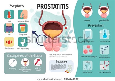 Vector Medical Poster Prostatitis Infographics Diseases Stock Vector