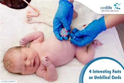 Interesting Facts On Umbilical Cords Cordlife India