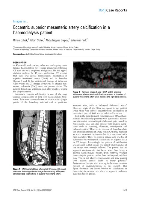 Pdf Eccentric Superior Mesenteric Artery Calcification In A