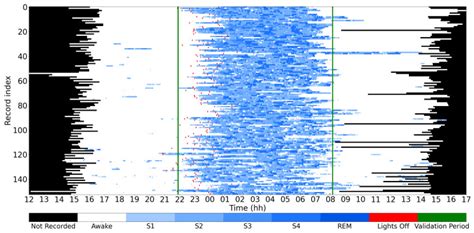 Model Based Electroencephalogram Instantaneous Frequency Tracking Application In Automated