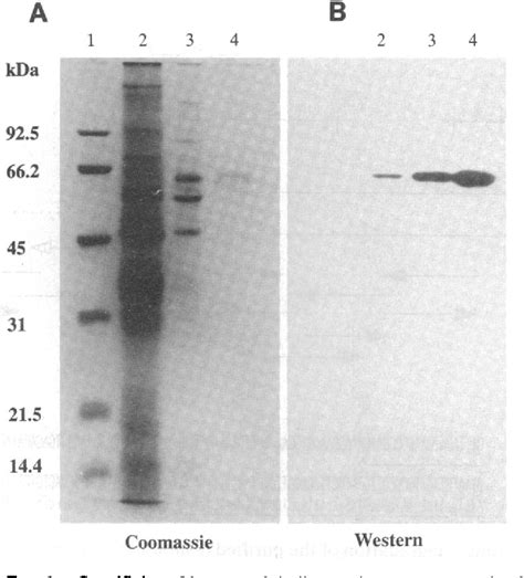 Figure 1 From Prolyl 4 Hydroxylase Molecular Cloning And The Primary