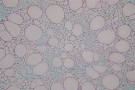 횡단면 Dicot Monocot 및 교실 교육에 대 한 현미경 아래 식물 줄기의 루트 과학에 대한 스톡 사진 및 기타 이미지
