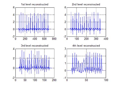 Daubechies Wavelet On Ecg Signal Download Scientific Diagram