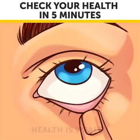 Bishal Nandi ↗️ On Linkedin Share Reshare Health Mentalhealth