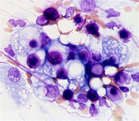 Veterinary Clinical Pathology Cytology Imprint Of Nasal Discharge From A Cat
