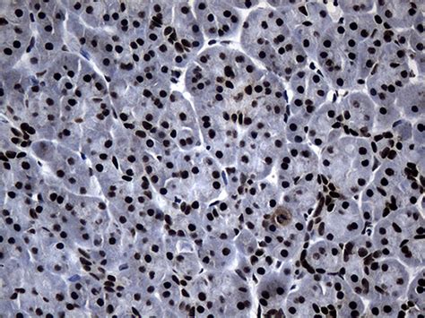 Anti Polr2a Rna Polymerase Ii Antibody Mouse Anti Human Ihcwb Lsbio