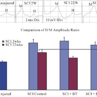 H Reflex Test With Comparison Of H M Amplitude Ratio Representative Download Scientific