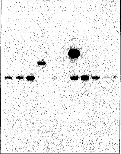 3 Southern Blot Analysis Of Bandll Digested Genomic Dna Of Diocrcnt