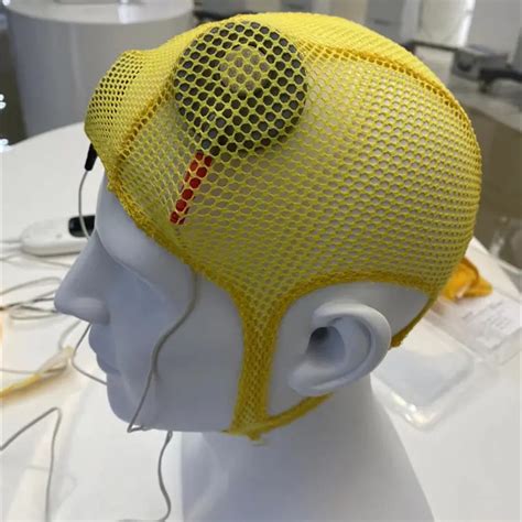 Transcranial Direct Current Stimulation Tdcs For Adhd Therapy