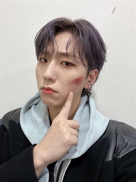 𝘟𝙙𝙞𝙣𝙞𝘳𝘺 😈 On Twitter Luka Luka Luka Yang Kurasakan