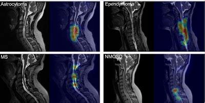 Radiology Artificial Intelligence On Twitter DeepLearning Pipeline
