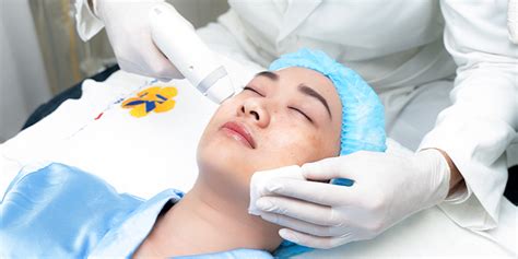 What Is Meso Exosome Injection Suitable For Whom What Benefits