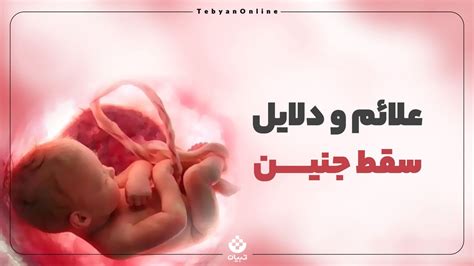 علائم و دلایل سقط جنین