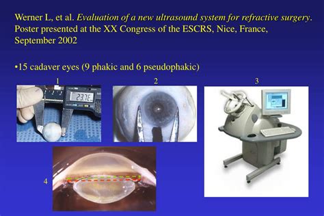 Ppt Phakic Posterior Chamber Iols Powerpoint Presentation Free