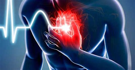 Enfermedades Cardiacas Mind Map